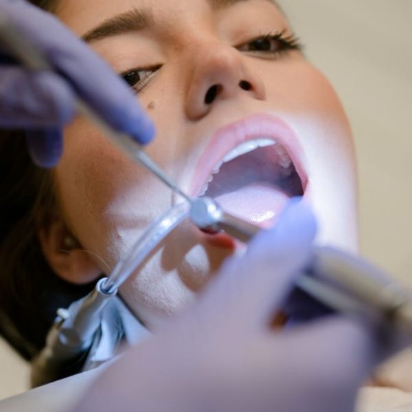 Tooth Extraction: What To Expect During The Dental Procedure